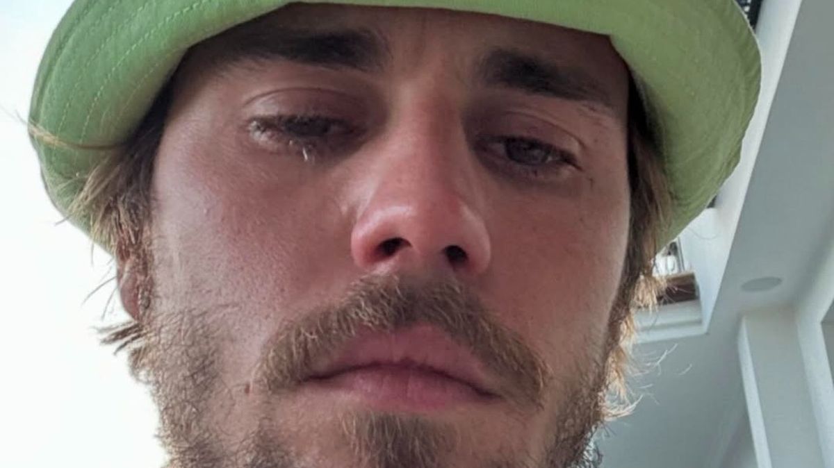 Justin Bieber shares sad health update after 'gnarly' skateboard accident
