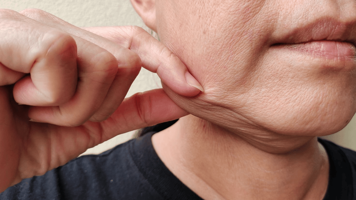 Mounjaro users seek advice after noticing ‘turkey neck’ side-effect of ...
