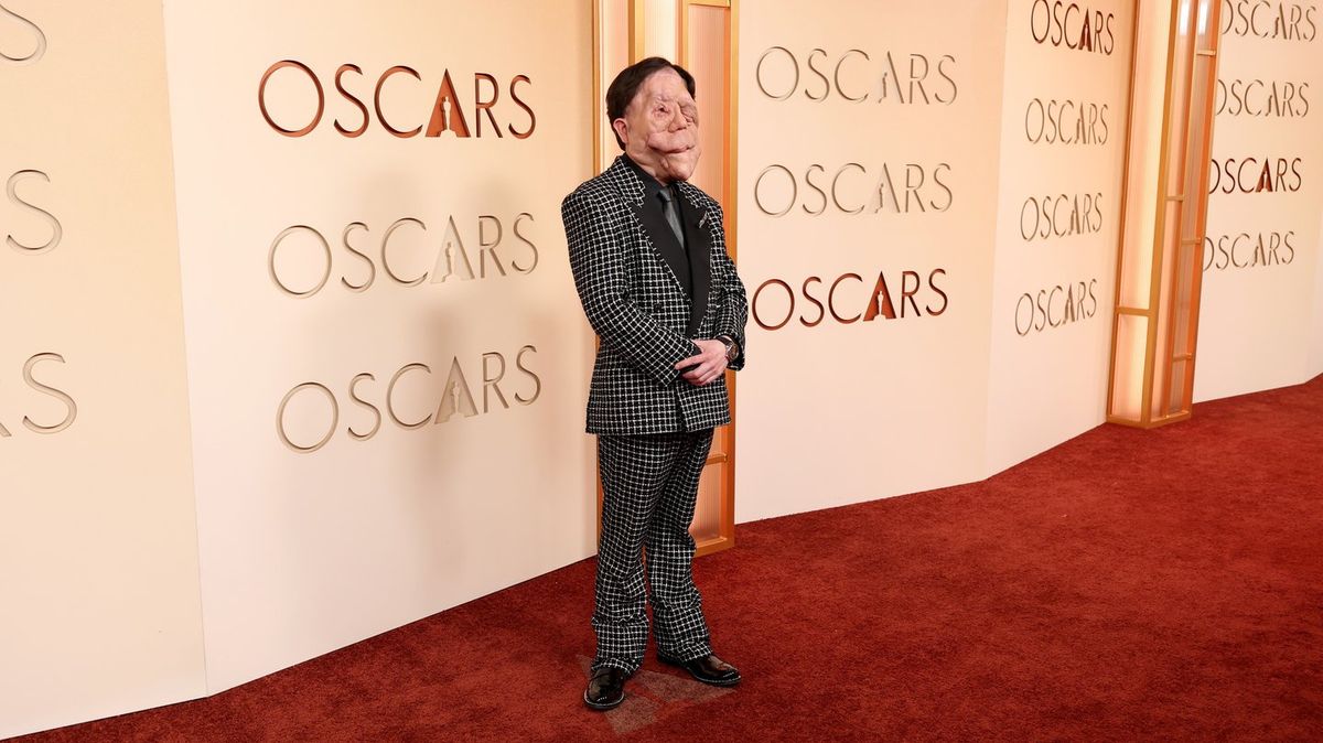 Actor Adam Pearson hits back at comedian’s ‘hateful’ tweet about his ...
