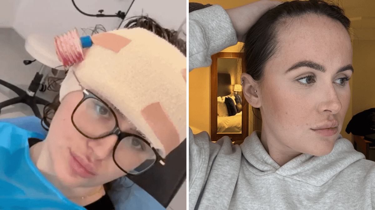Woman who splashed £9,000 on forehead reduction reveals real reason why ...