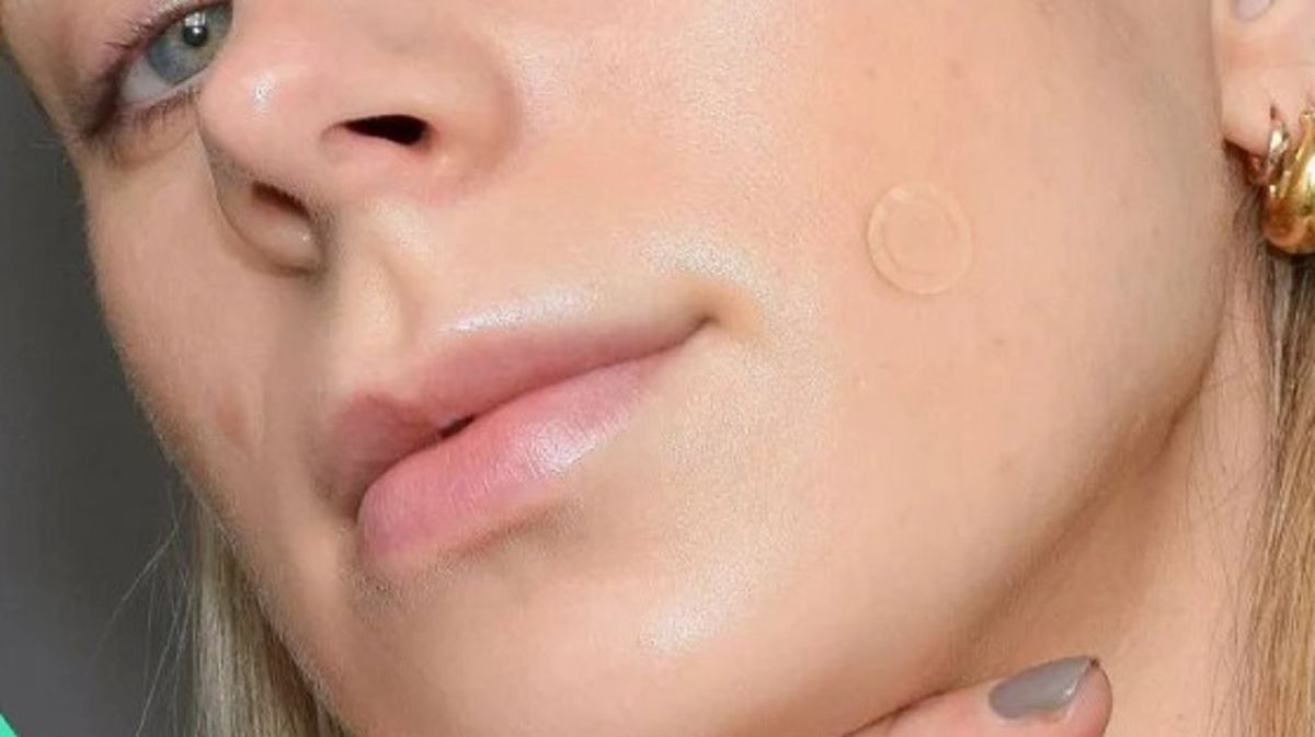 How 'life-saving' spot patches actually work as expert speaks out