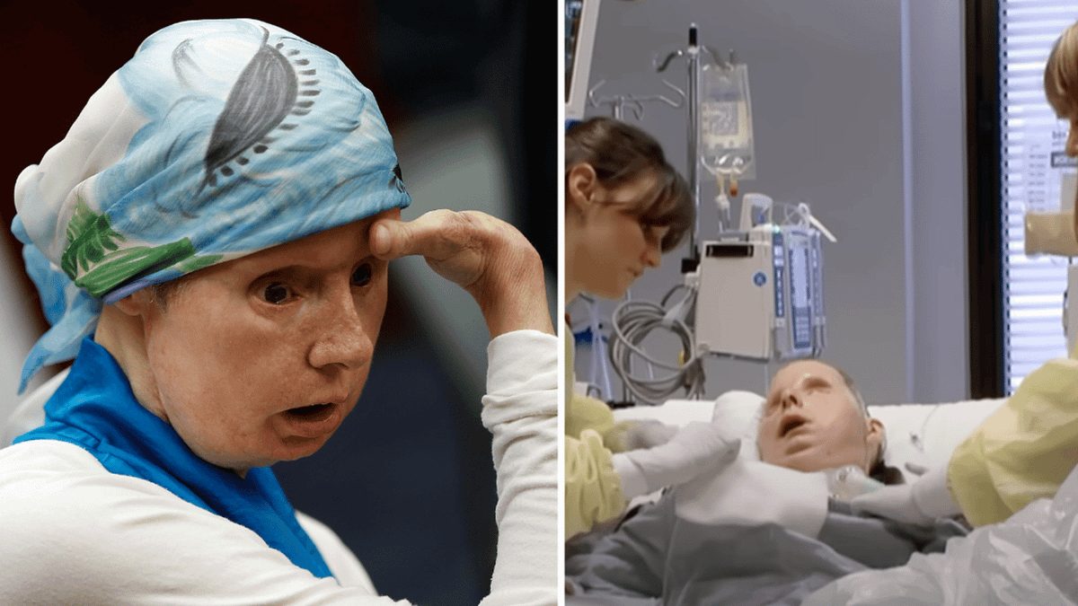 Woman whose face was ‘ripped off’ by chimpanzee shares unbelievable ...