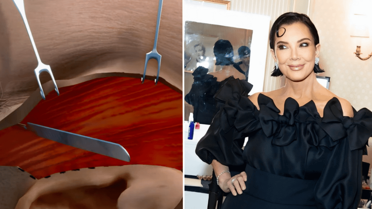 Gross animation shows how facelifts are done after Kris Jenner makes ...