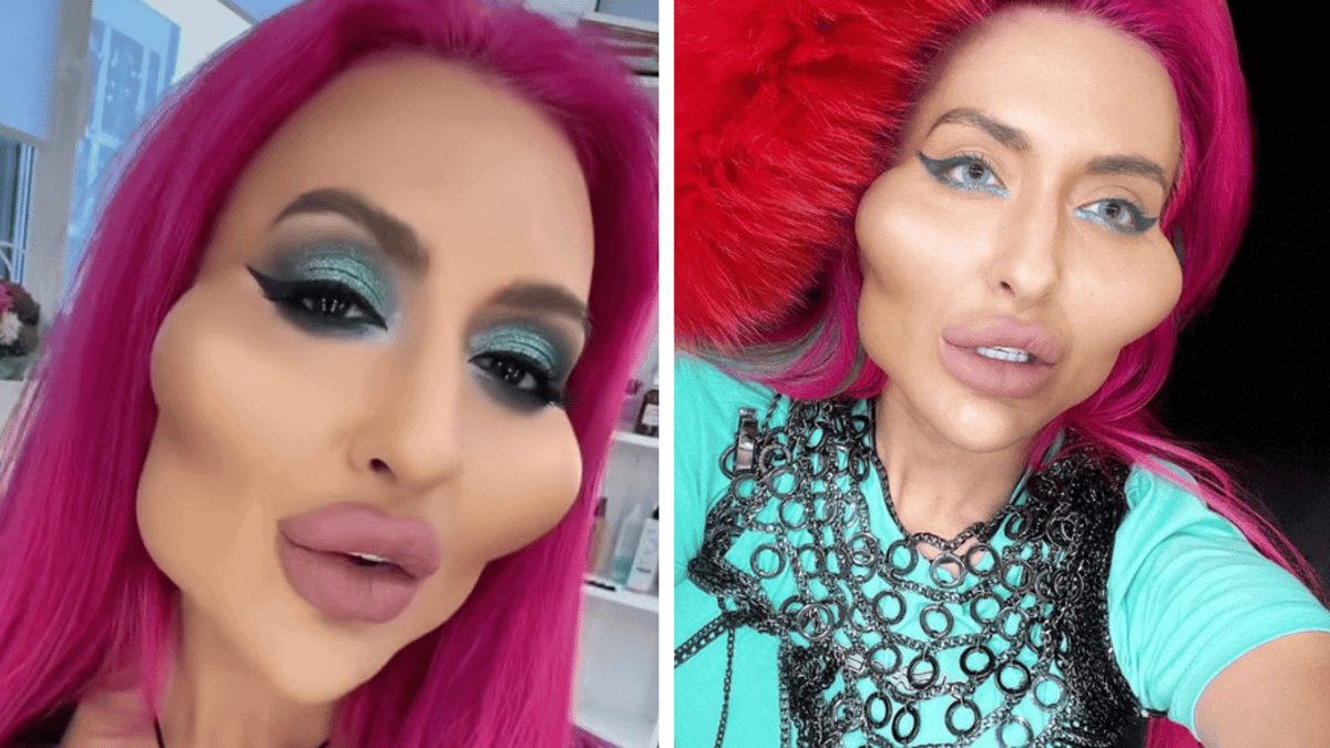 Woman with 'world's biggest cheeks' shows what she looked like before ...