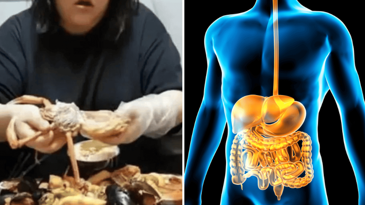 How you can die from eating too much food after extreme eater passes ...
