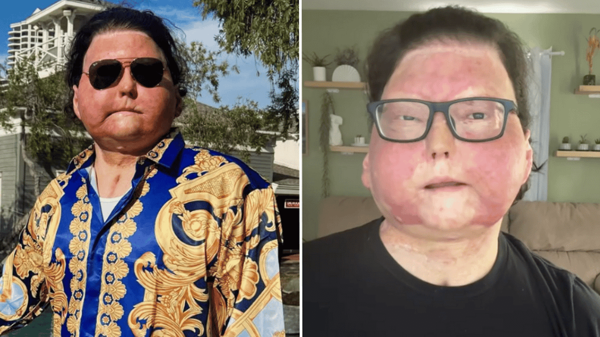 Man who received 47-year-old’s face asked unusual question about ...