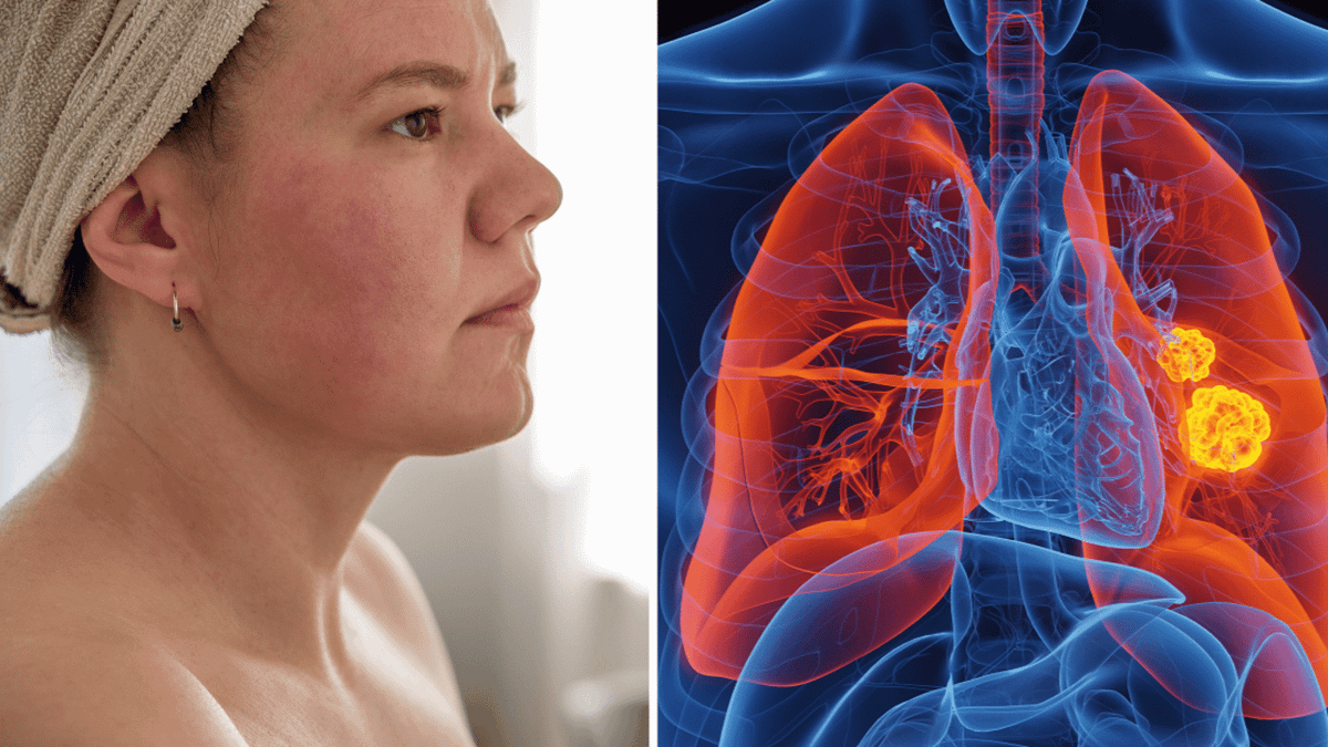 Women warned over cancer symptoms you might see in your face that most ...