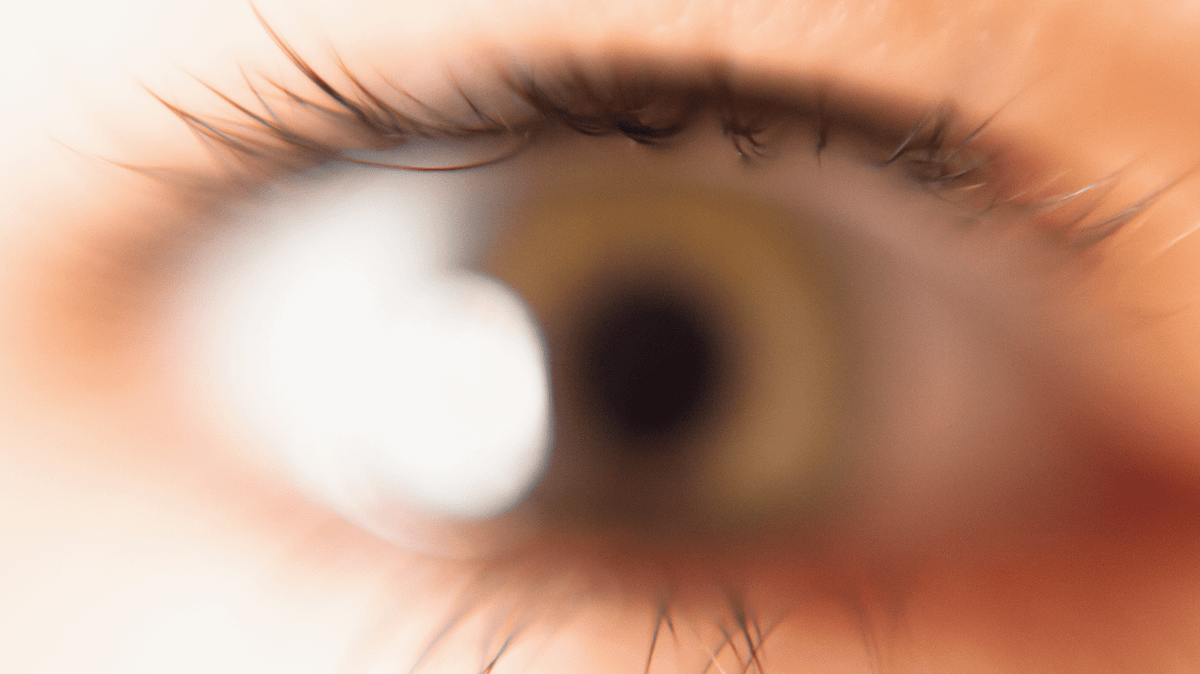 What it means if you can blur your own vision and when to be concerned