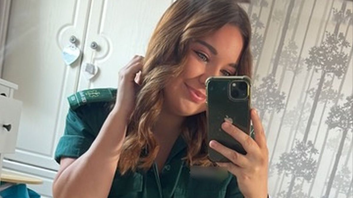 Woman who blamed ‘buffalo bump’ and ‘moon face’ on date nights given ...