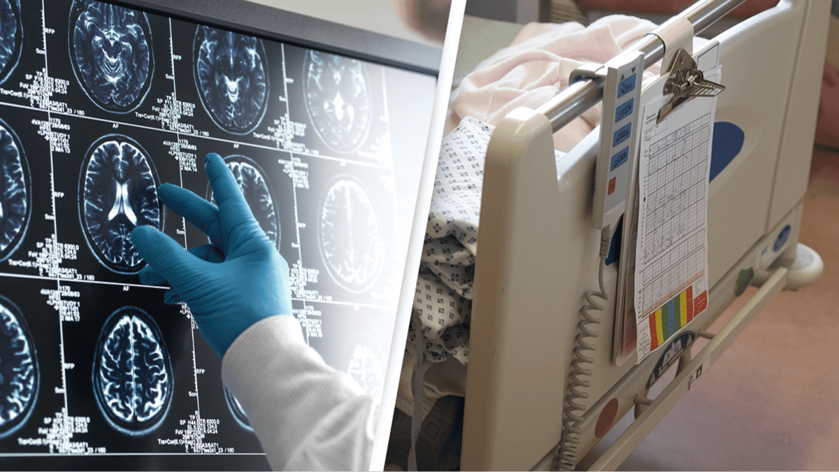 Man destroyed part of his brain causing severe OCD after shooting ...