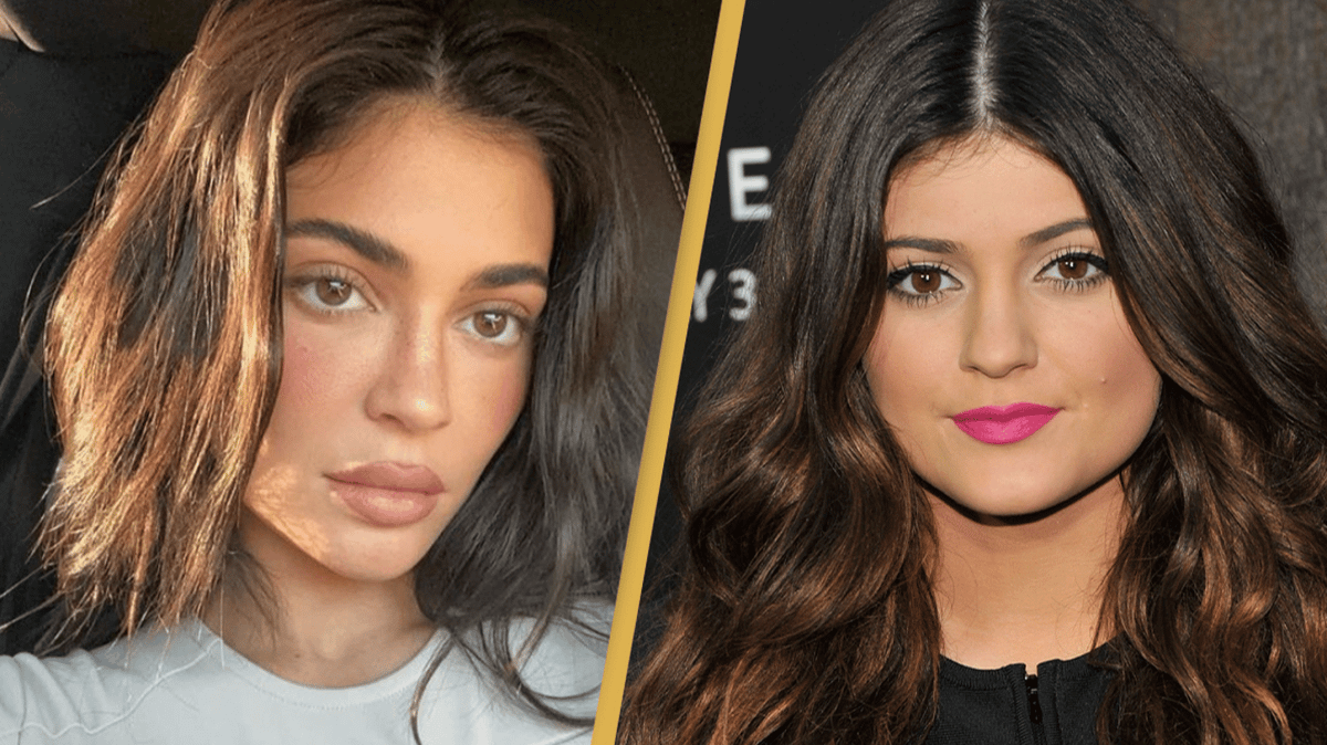 Kylie Jenner explains why she looks so different in before and after ...