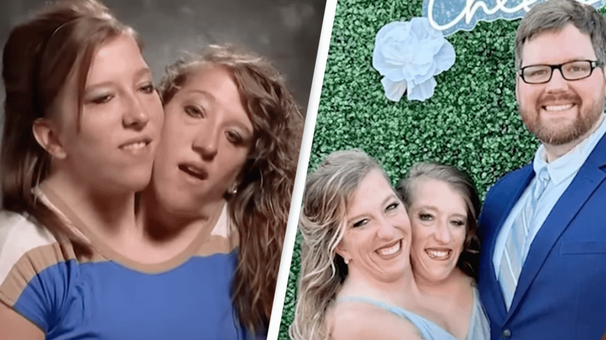 Everyone is asking the same thing after finding out conjoined twin Abby ...