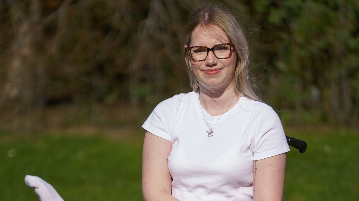 Woman, 21, left needing both legs amputated after her legs started ...