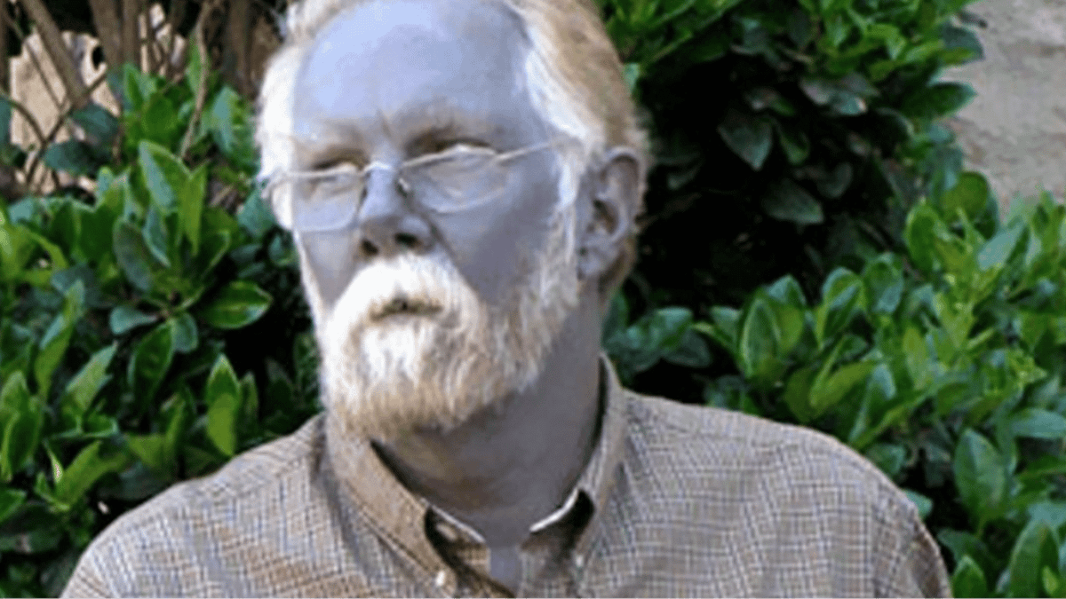 Bizarre case of man who suffered horrific side-effect and turned ...