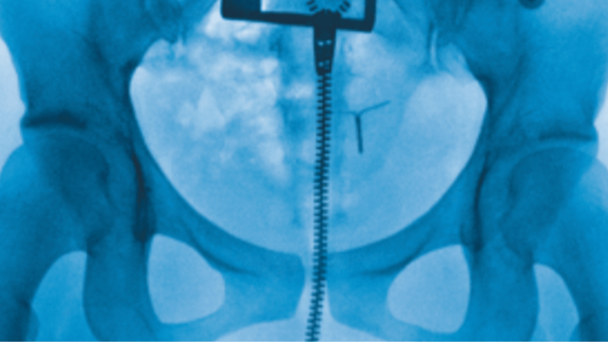 People shocked after learning disturbing detail X-ray can see after ...