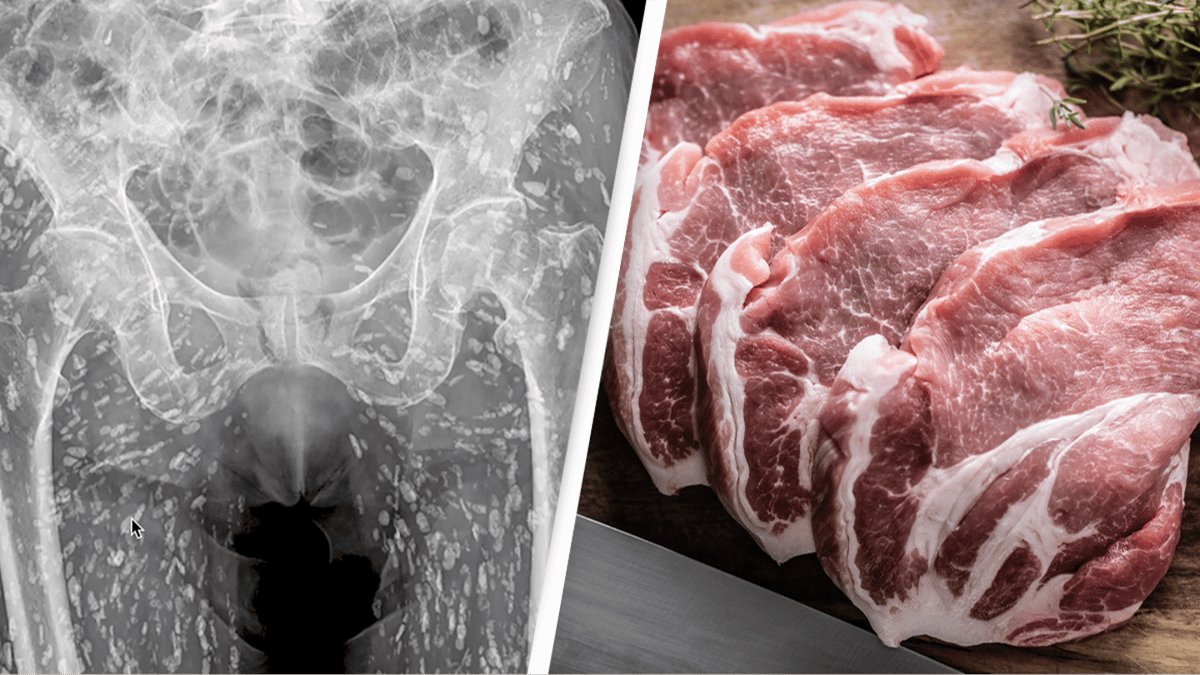 ER doctor breaks down horrifying scans that show parasite-infested body ...