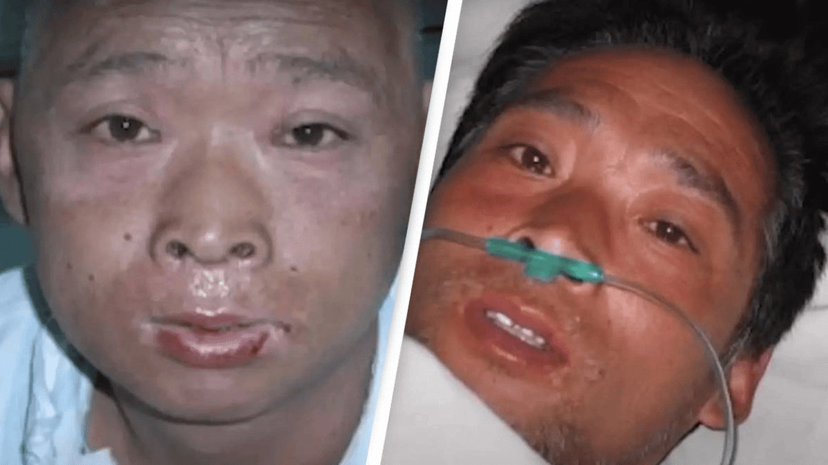Man suffered most painful death ever recorded in human history that ...
