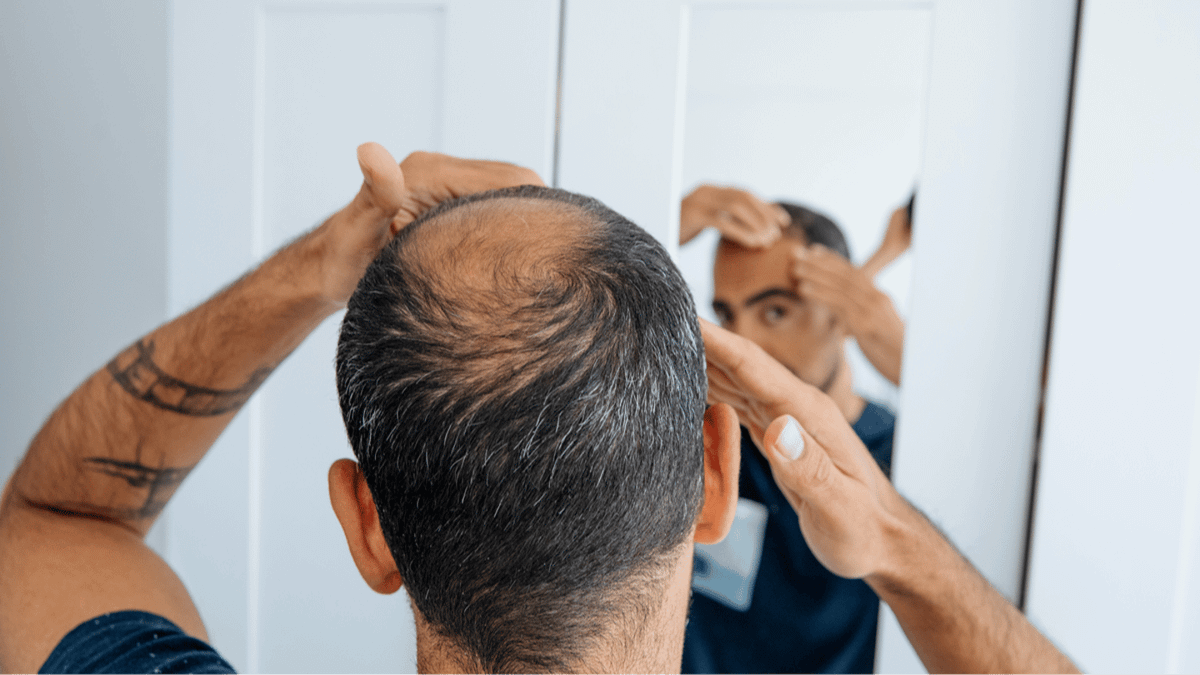 Scientists discover breakthrough 'cure' for hair loss which takes just ...