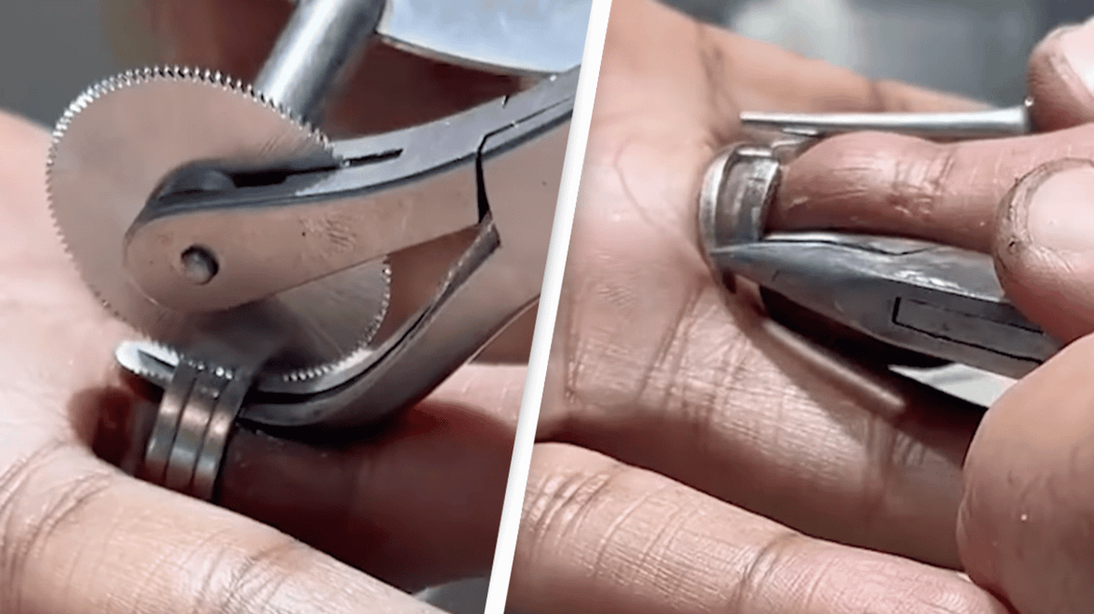 Woman gets rings removed from her finger after they were stuck for 15 years