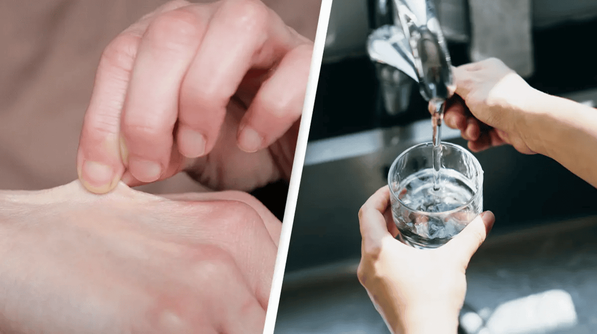 Doctor reveals simple 'pinch test' that can tell if you're dehydrated ...