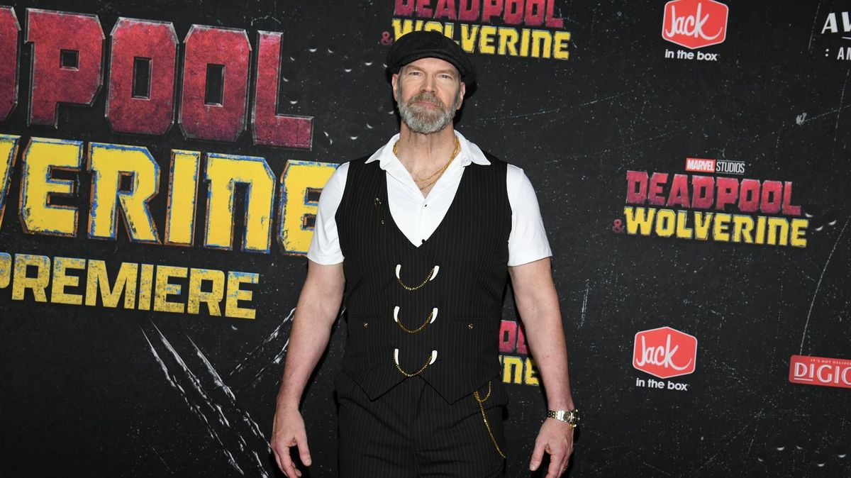 Male breast cancer signs as X-men star reveals 'super rare' diagnosis