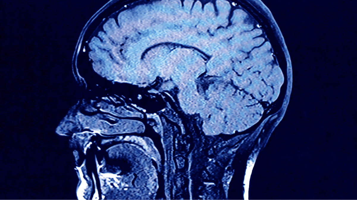 'Popcorn brain' explained as study shows scrolling social media could ...