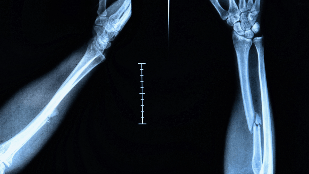 Doctor speaks out on three bizarre theories about people who have ...