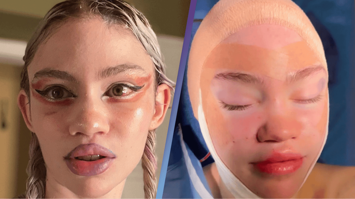 Grimes posts selfie for the first time after surgery and fans seem ...