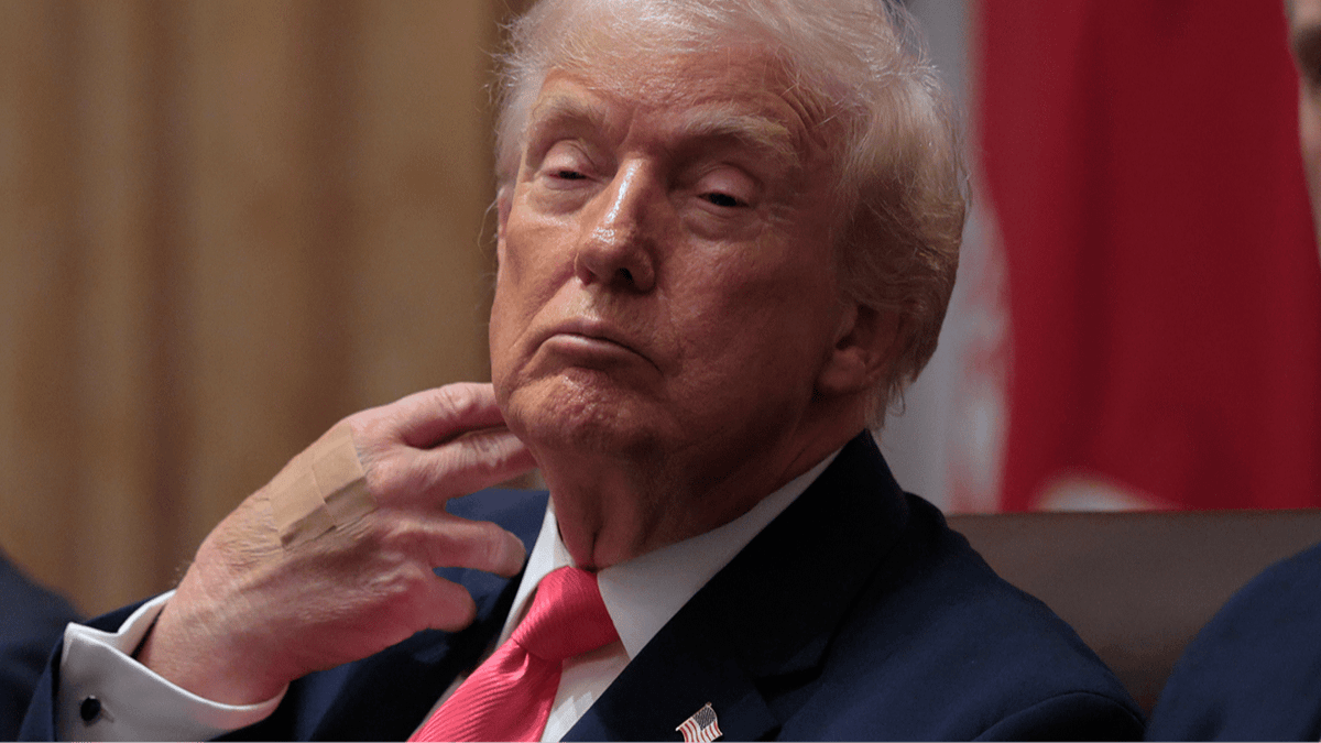 White House finally reveals surprising reason why Trump has bandages on ...