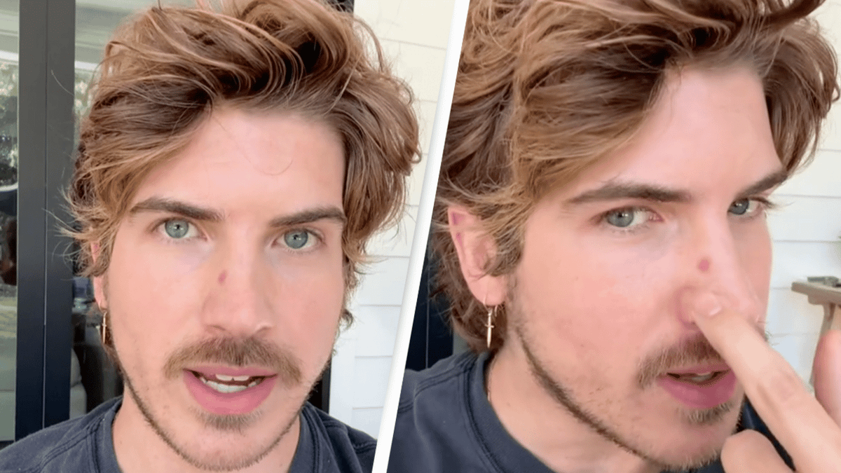 YouTuber Joey Graceffa has been diagnosed with skin cancer