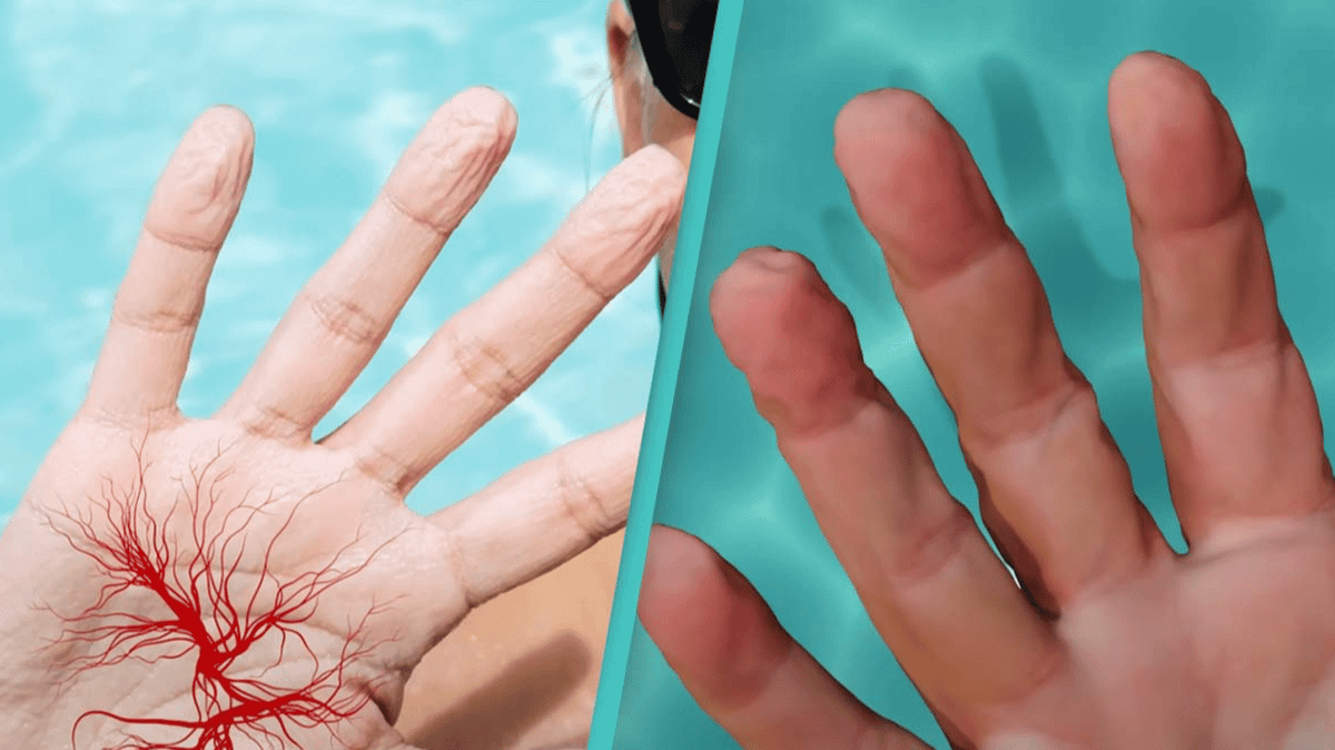 Bizarre simulation shows why fingers wrinkle when wet but it doesn't ...