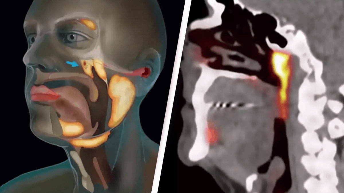 Scientists accidentally discovered a whole new organ in the human body