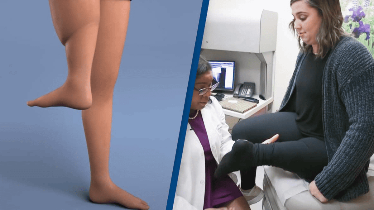 Life saving surgery that actually turns your leg around is leaving ...