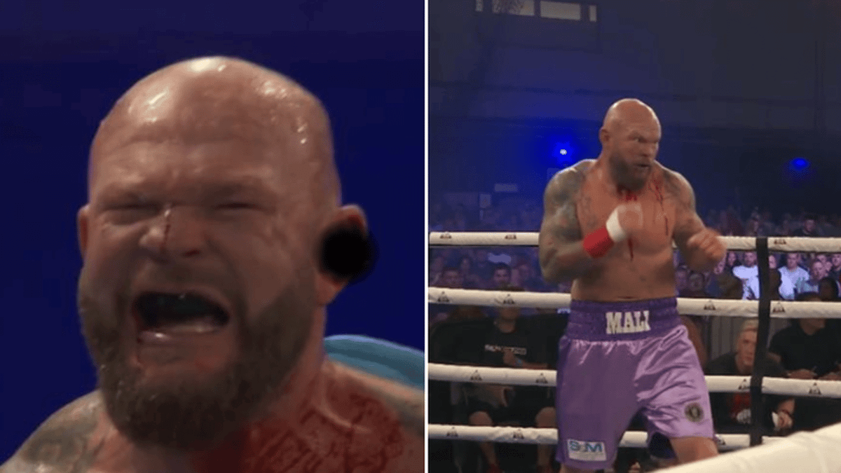 Anthony Joshua’s former opponent has ear RIPPED OFF during brutal bare ...