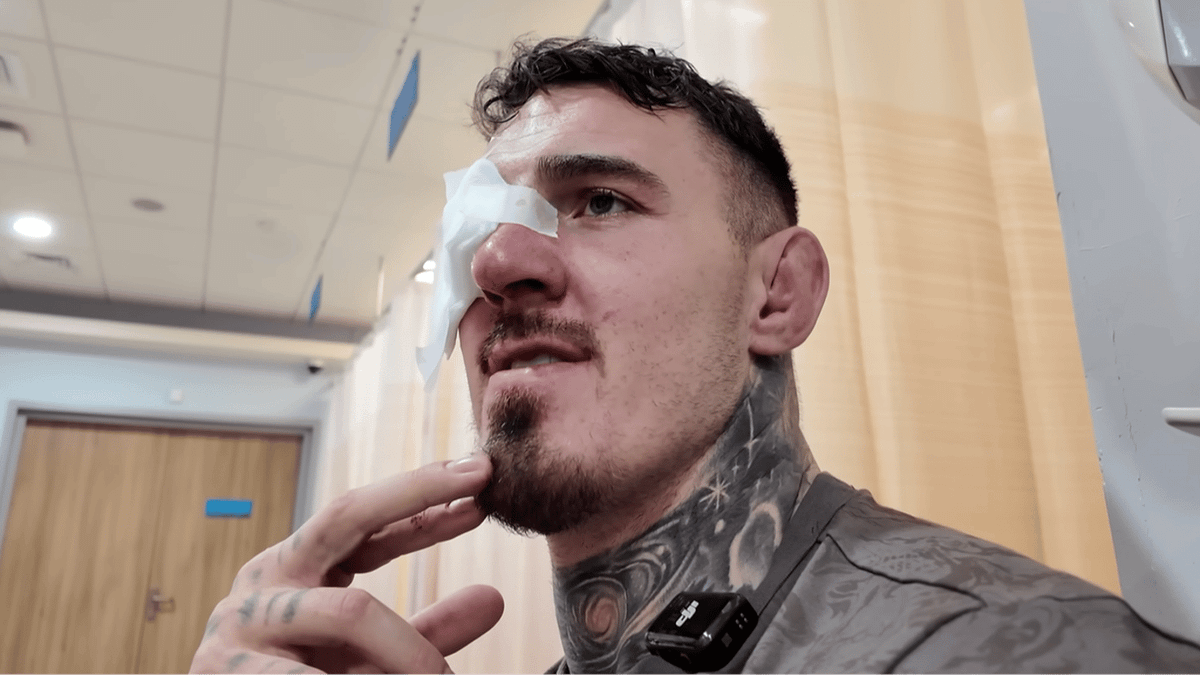 Tom Aspinall To Take Drastic Action If He Has Permanent Eye Damage