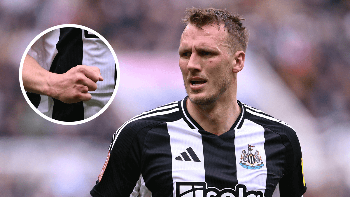 Gruesome reason why Dan Burn is missing a finger as he receives first ...