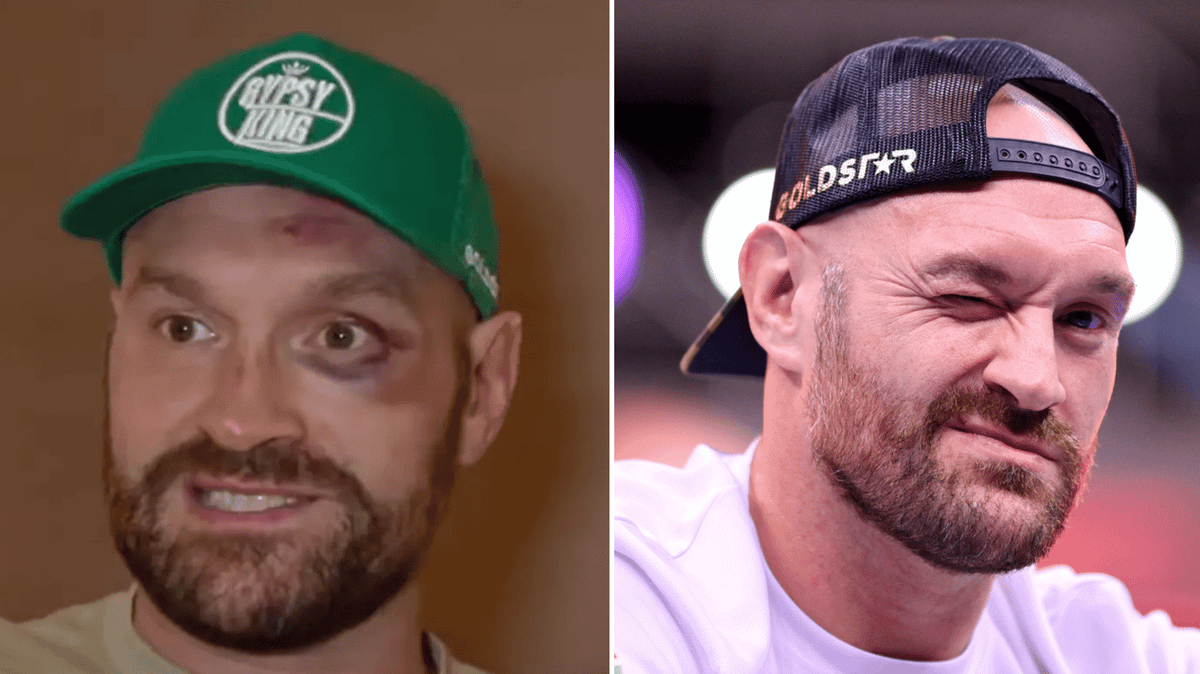 Tyson Fury branded an 'embarrassment' over major U-turn as quotes come ...