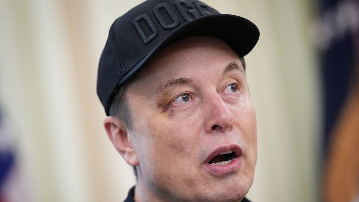 Elon Musk reveals who punched him as he sports black eye at Oval Office ...