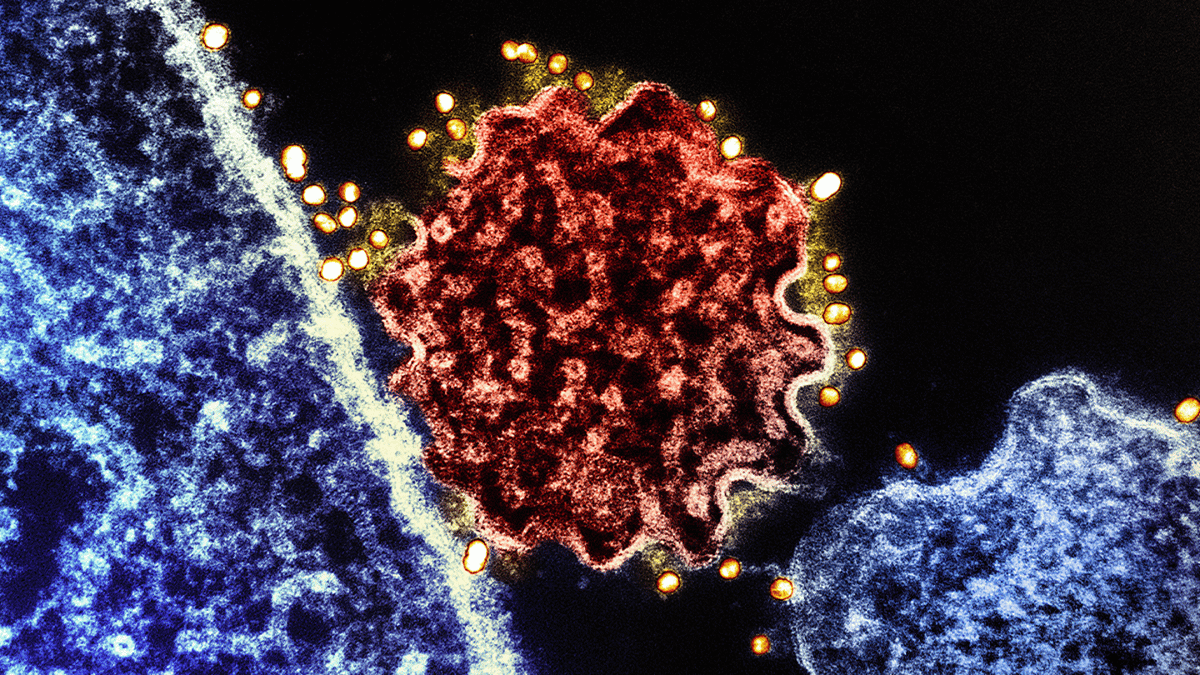 Australian officials issue update amid outbreak of one of the ...