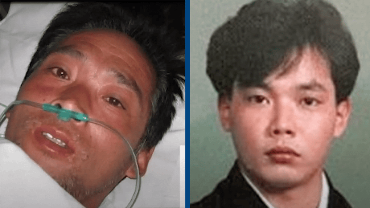 What happened to 'radioactive man' who suffered for 83 days before ...