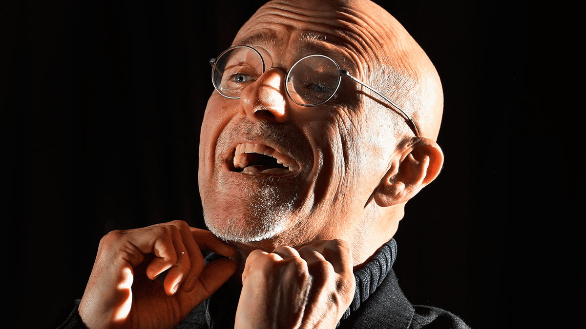 Surgeon claims he's ready to do the world's first ever human head ...