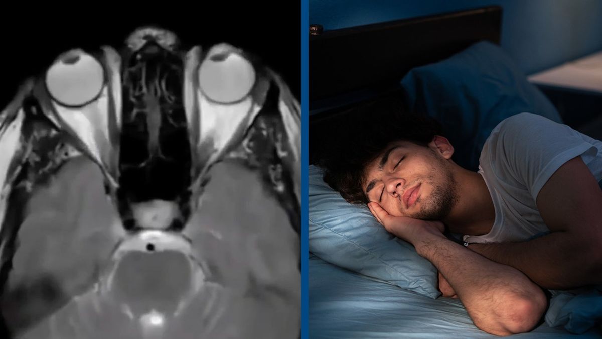 Video of how our eyes look during REM sleep is seriously freaking ...