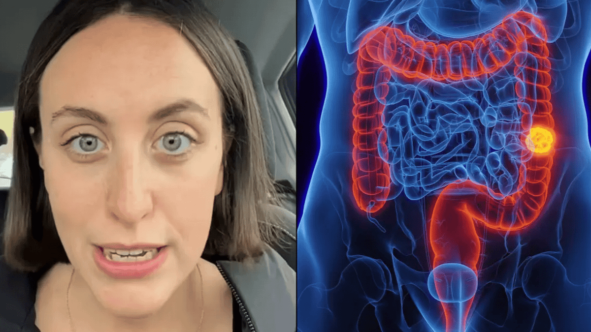 Woman diagnosed with bowel cancer aged 25 reveals unusual symptom all ...
