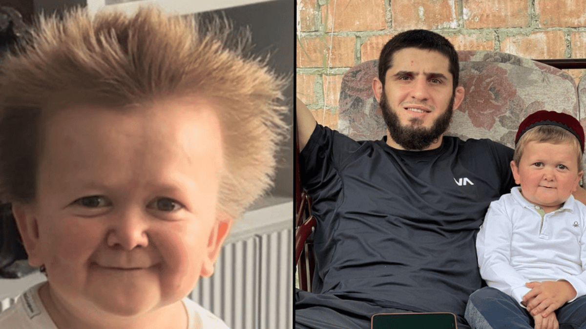 Why Hasbulla looks so much younger than he actually is
