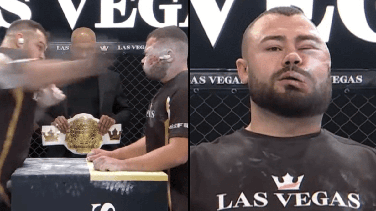 Man left brutally disfigured after 20 minute slapping championship match