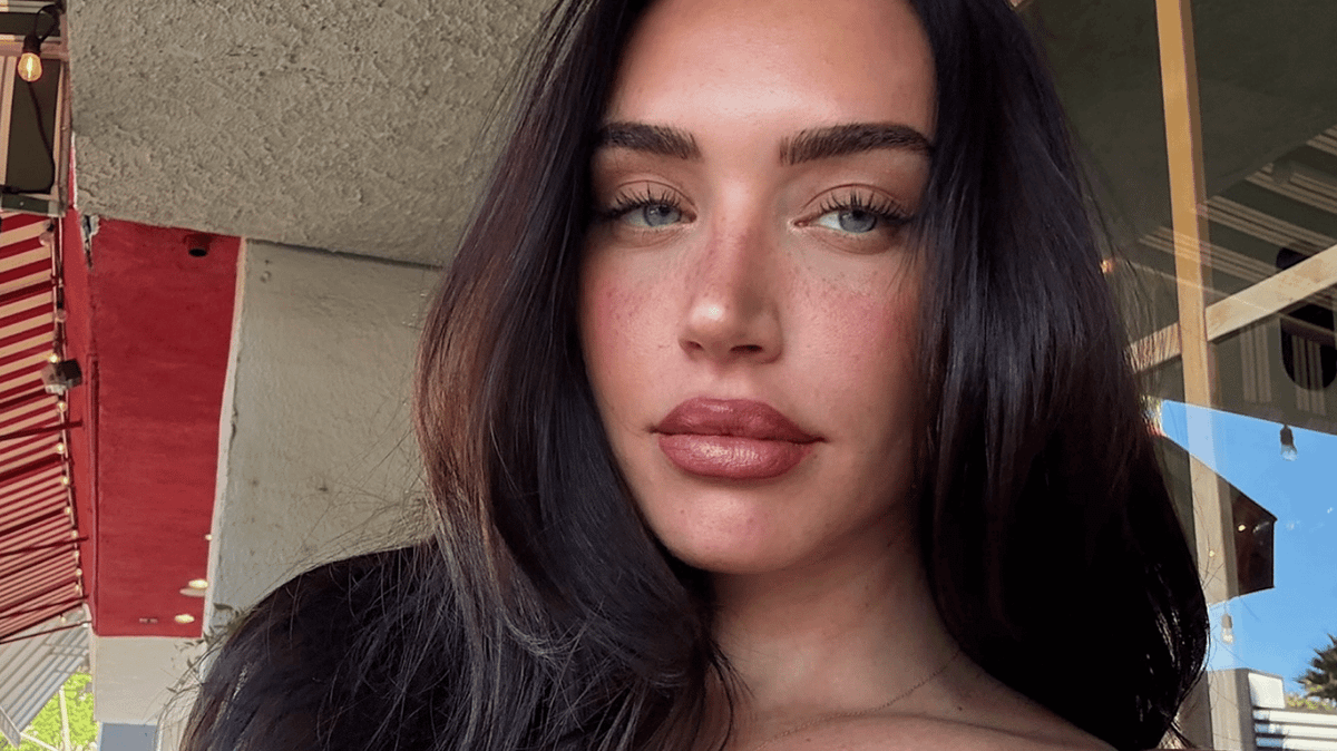 Influencer 'Stassie Baby' reveals why she got 'butt reduction surgery ...