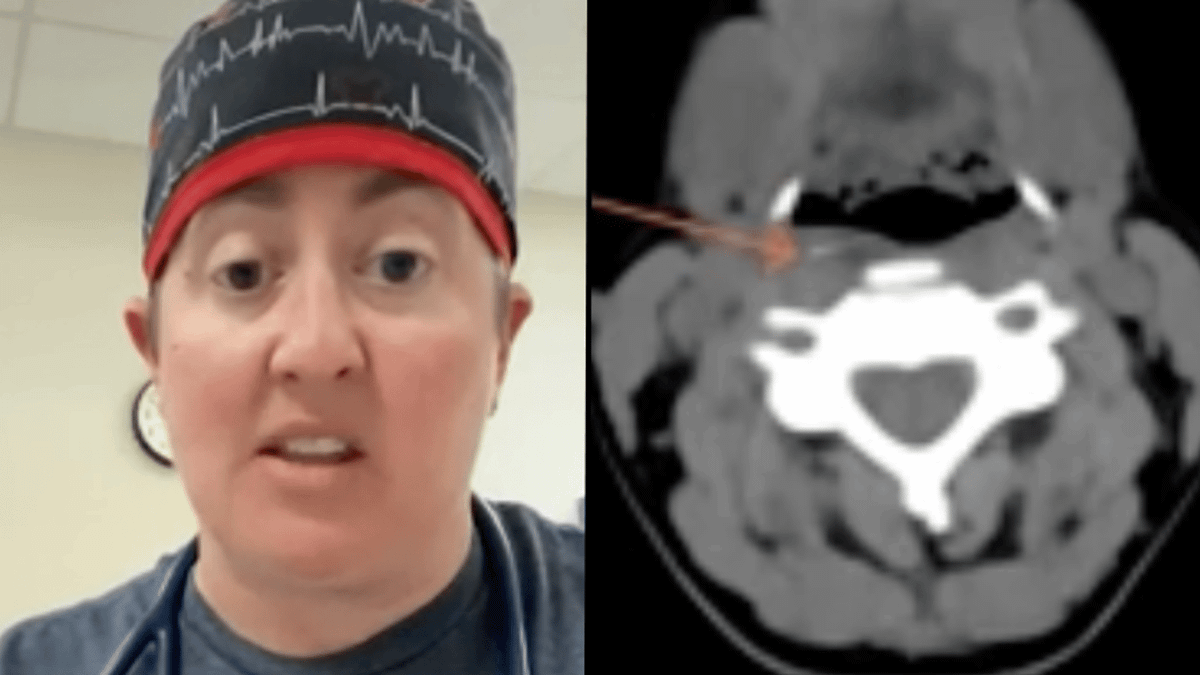Doctor makes disturbing discovery after results come back normal for 4 ...