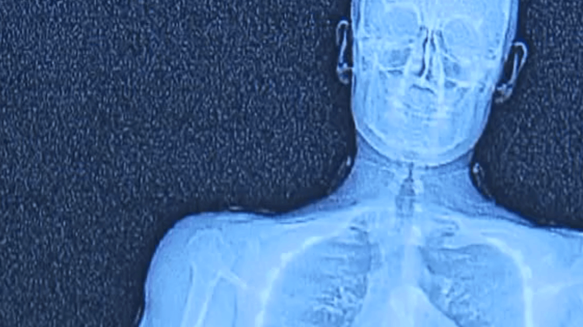 People shocked after seeing what jail X-ray scanner can really see