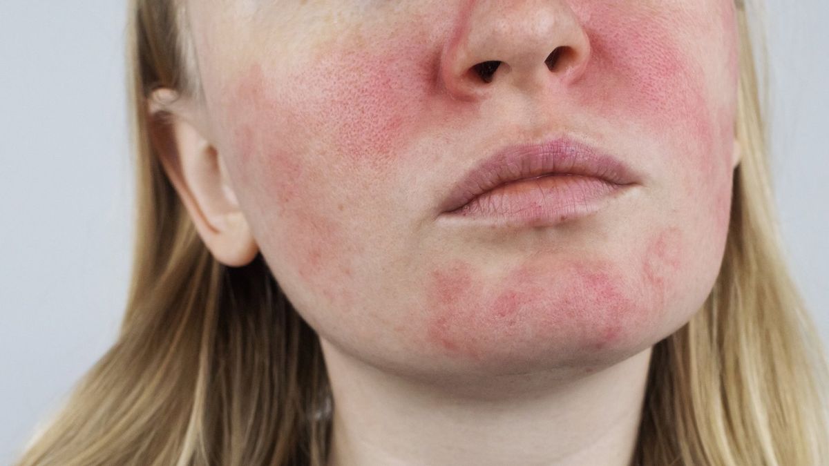 Disturbing truth behind why your skin goes red when you drink alcohol