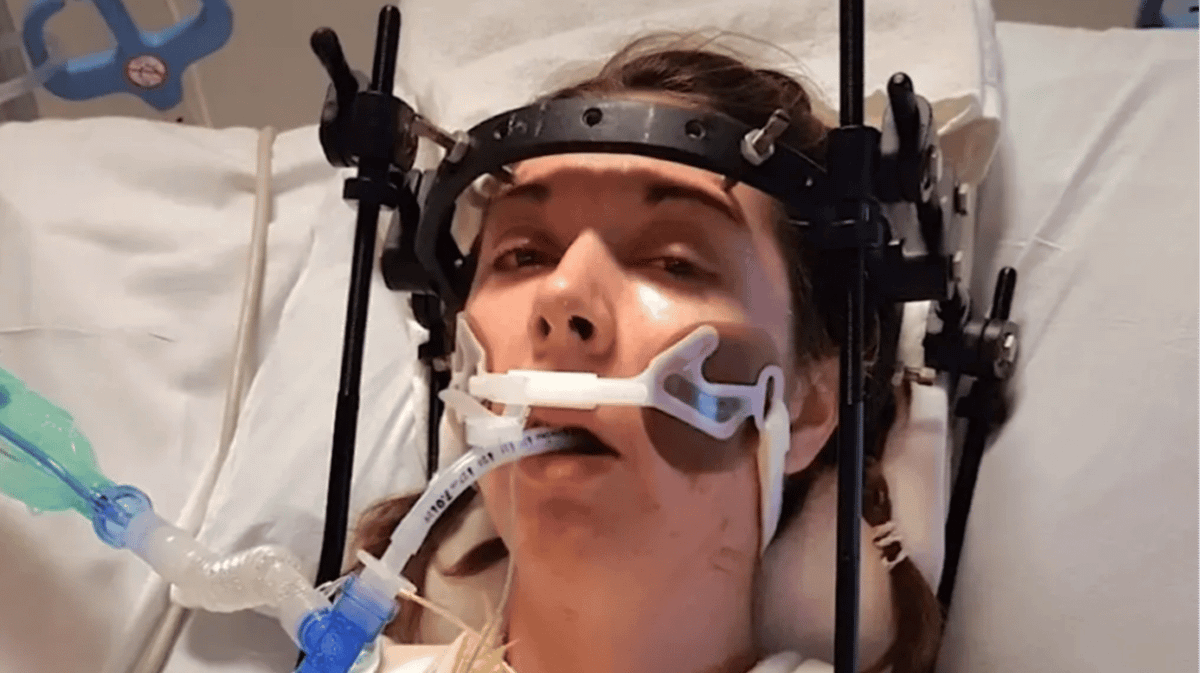 Woman whose head was 'decapitated' following 'horror' accident has it ...